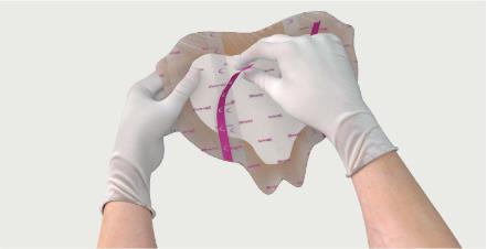 Buy Molnlycke Mepilex Border Sacrum Foam Dressing with Safetac