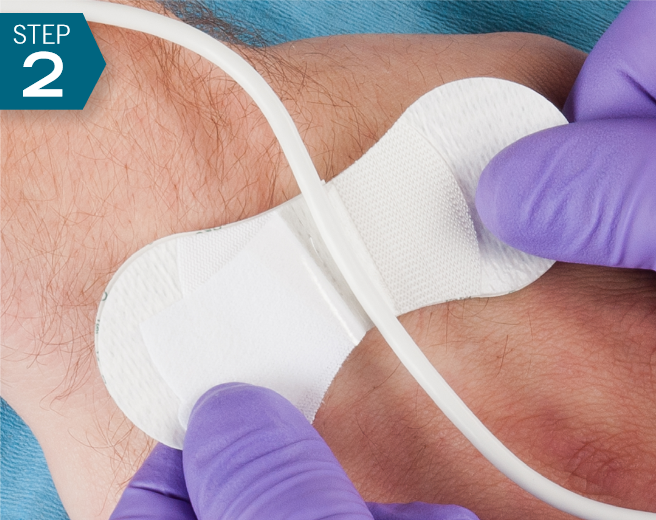 Buy Grip-Lok Medium Universal Securement Device & Save Lots!