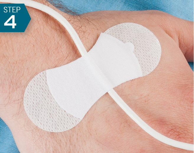 Buy Grip-Lok Medium Universal Securement Device & Save Lots!