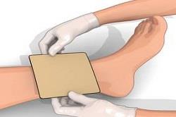 Buy Actisorb Silver 220 Activated Charcoal Dressing