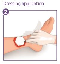 Buy Systagenix Promogran Matrix Wound Dressing [Use FSA$]