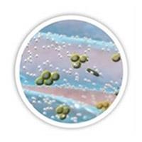 Buy Aquacel Ag Extra Hydrofiber Dressing | Wound Dressing