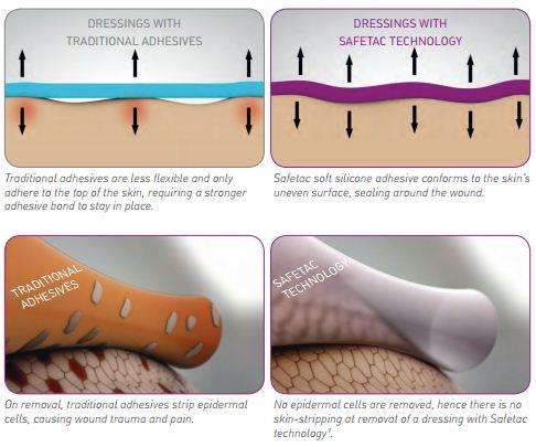 Molnlycke Mepilex Lite Soft Silicone Thin Foam Dressing with Safetac